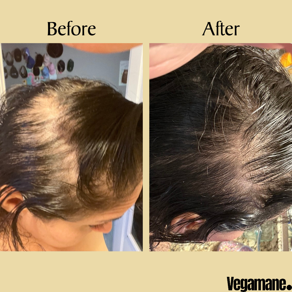 Vegamane Natural Hair Growth Oil – VegaMane