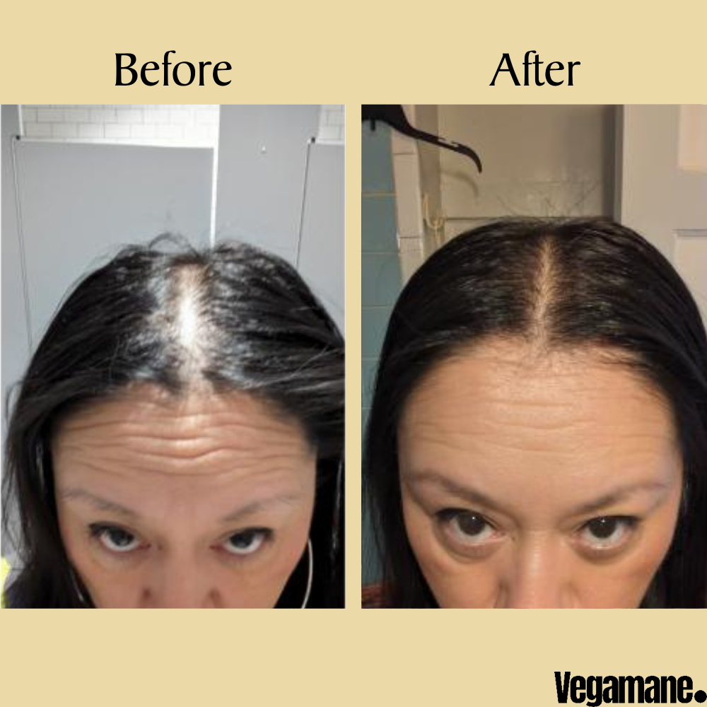 Vegamane Natural Hair Growth Oil – VegaMane